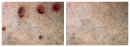 Carbomed-dermal | Technica Entwicklungsgesellschaft